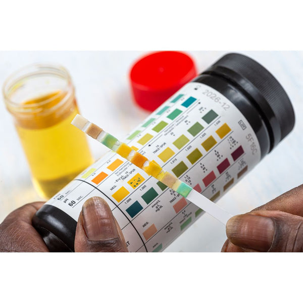 Why Testing Water Quality Matters and Choosing the Right Filtration Sy